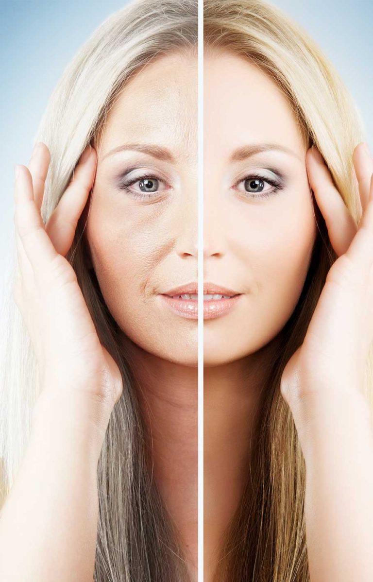 Botox-Vs-Vampire-Facial | Академия Кайдзен